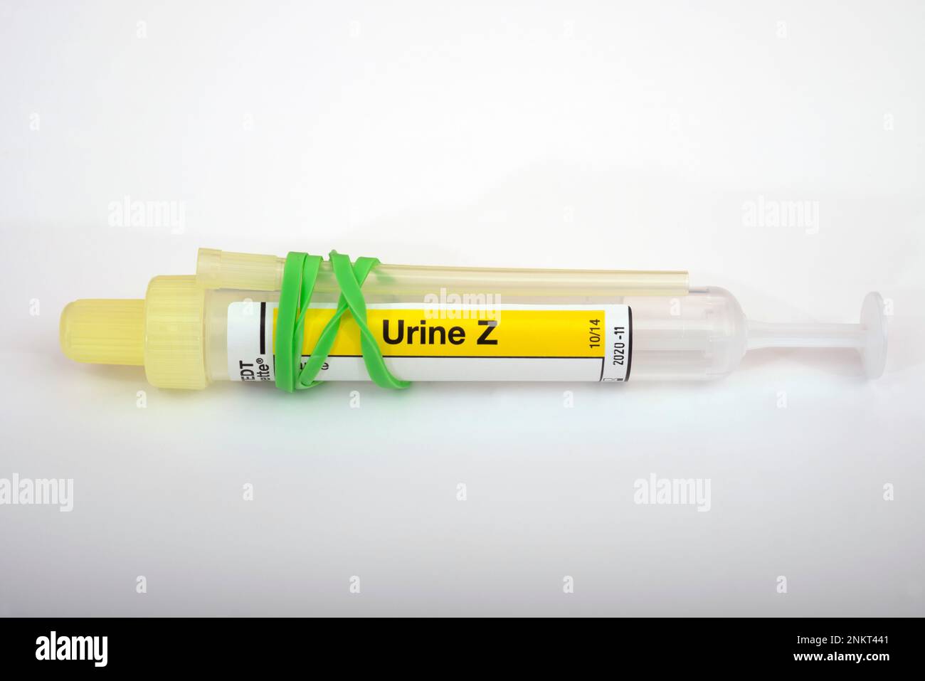 Urine Z specimen Stock Photo - Alamy