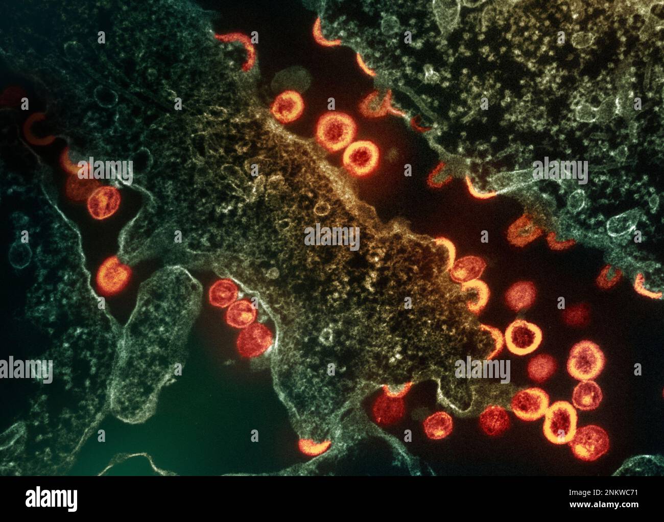HIV particles budding from cell, TEM Stock Photo - Alamy