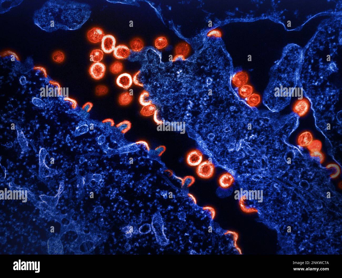 HIV particles budding from cell, TEM Stock Photo - Alamy