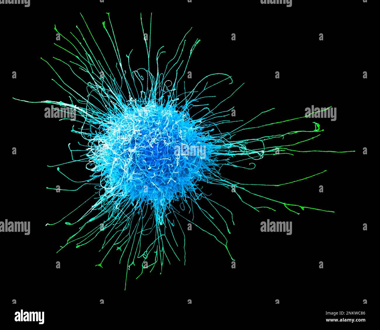 Cervical cancer cell, SEM Stock Photo - Alamy