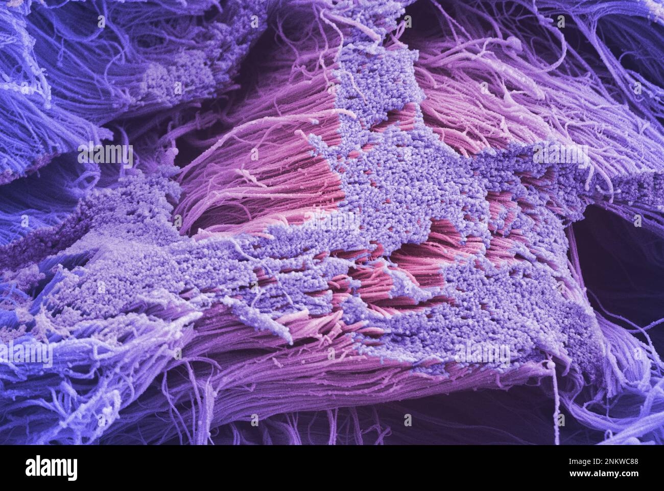 Human connective tissue, SEM Stock Photo - Alamy