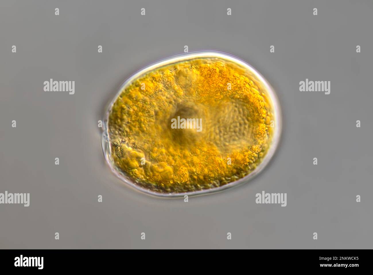 Prorocentrum lima algae, light micrograph Stock Photo - Alamy