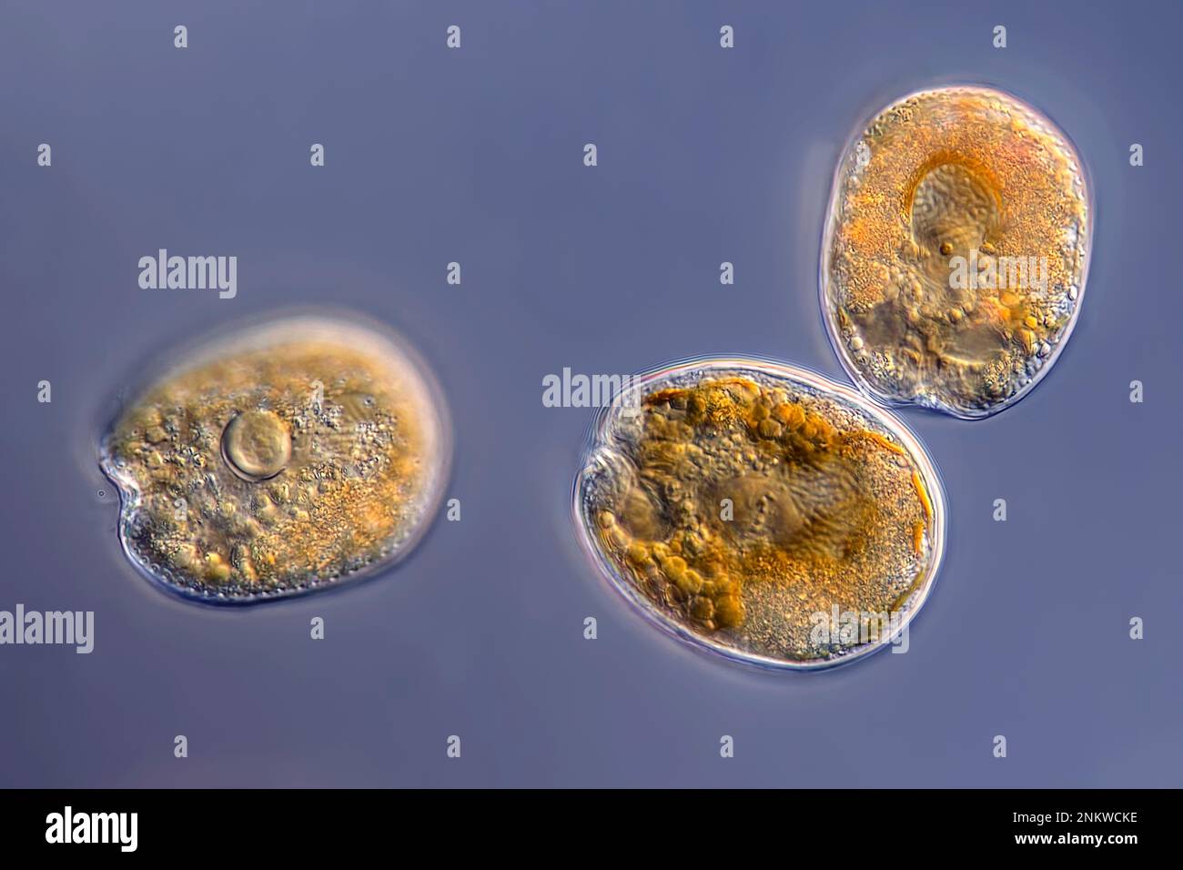 Prorocentrum lima algae, light micrograph Stock Photo - Alamy