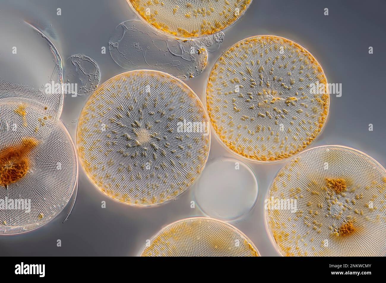 Coscinodiscus sp. algae, light micrograph Stock Photo - Alamy