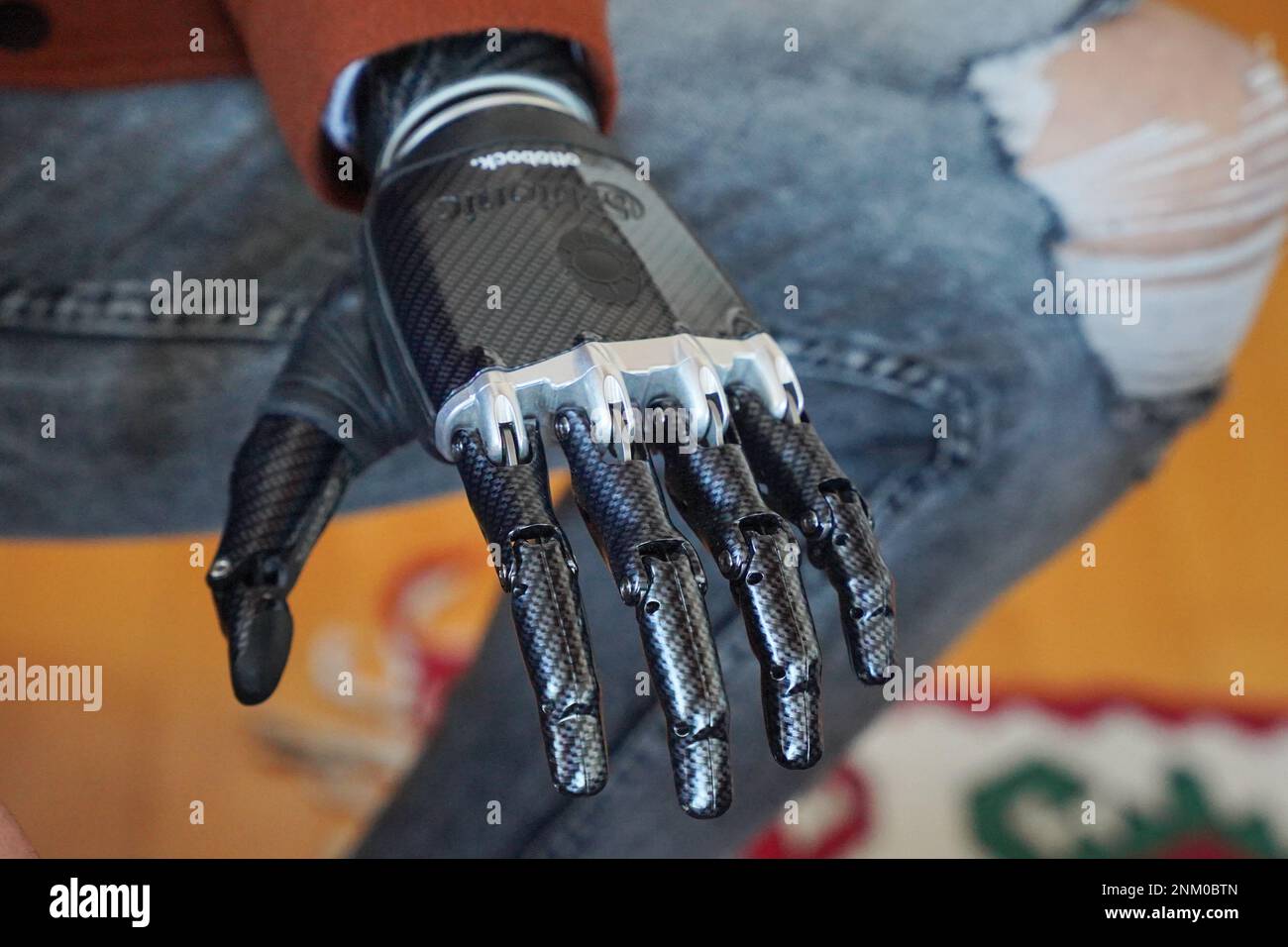 Amputated arm accident hi-res stock photography and images - Alamy