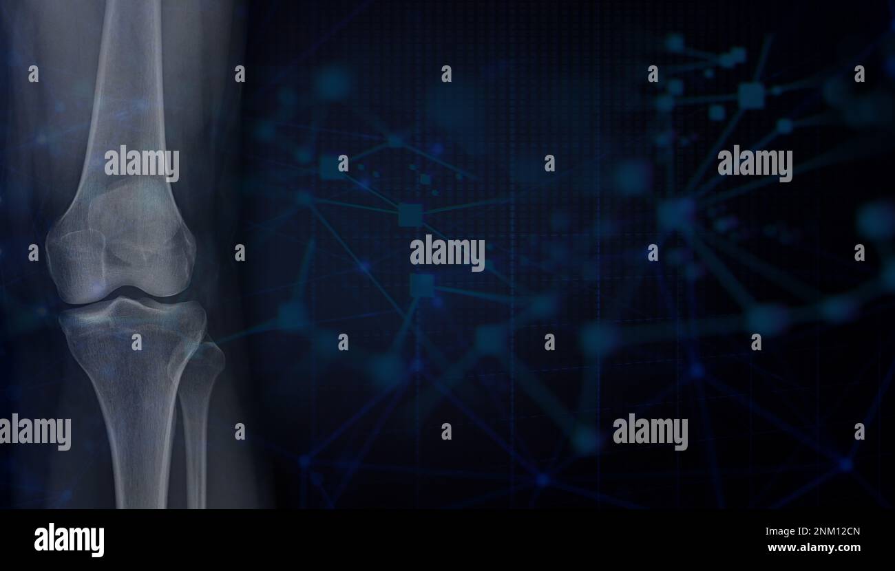 Film x-ray of Left knee joint AP view for Medical background 3D ...