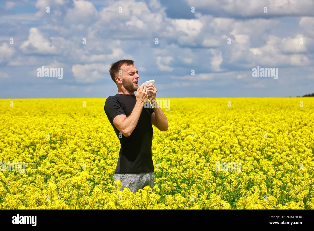 Young man in yellow canola field blowing his nose and suffering from ...