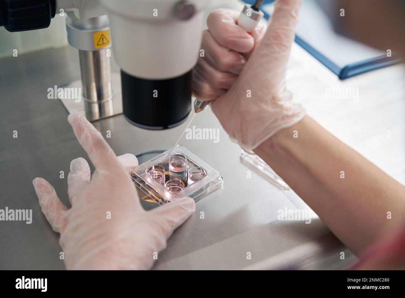 Doctor selects biomaterial with special syringe for subsequent ...