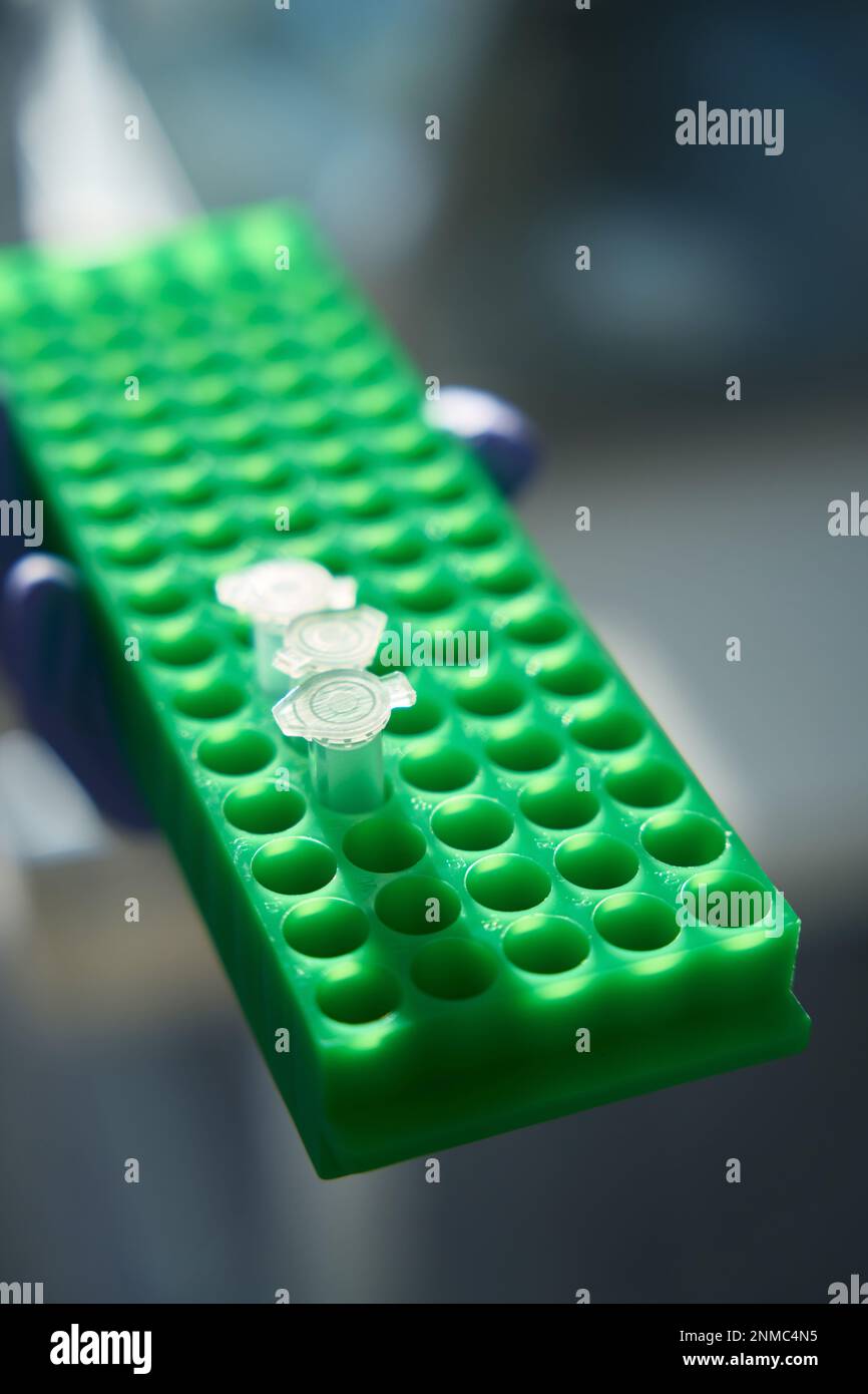 Samples of labeled biomaterial in a special laboratory unit Stock Photo ...