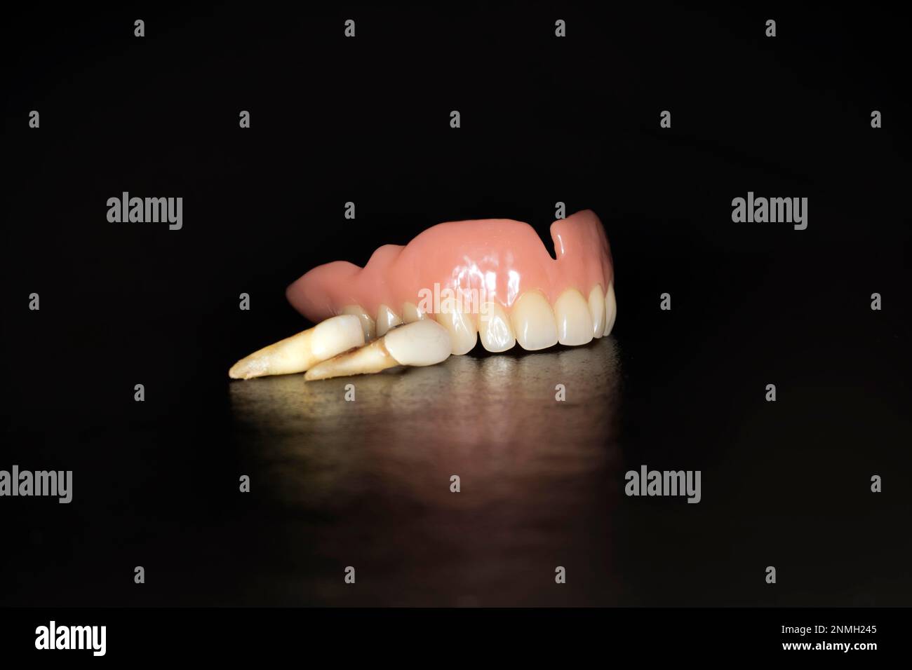 Denture upper jaw made of plastic with pulled teeth, studio photography ...
