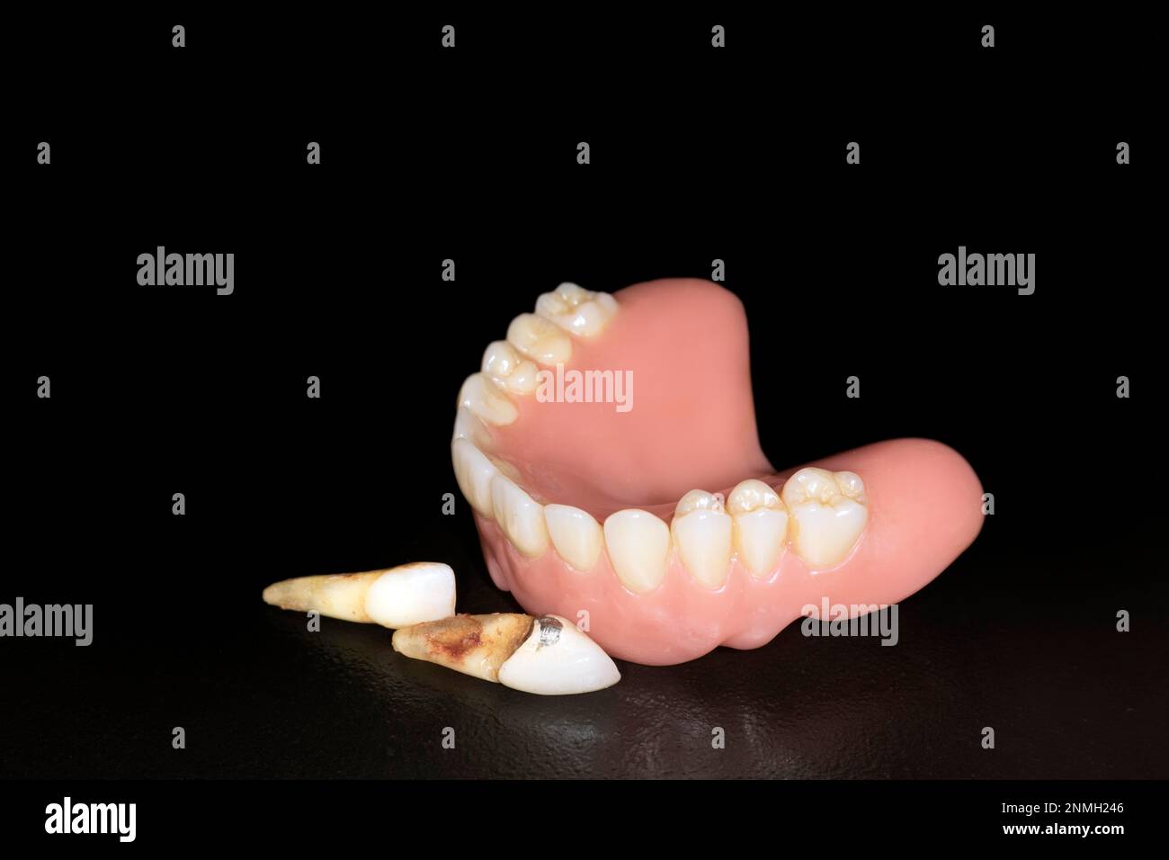 Denture upper jaw made of plastic with pulled teeth, studio photography ...