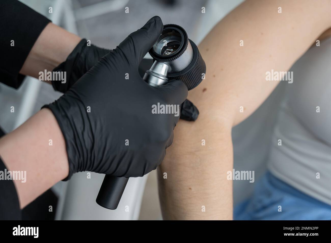 A dermatologist examines a patient's mole through a dermatoscope Stock ...