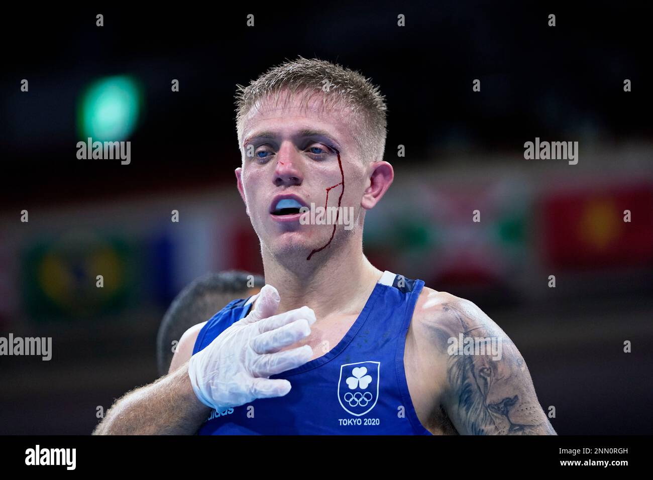 The referee puts his hand on Ireland's Kurt Anthony Walker during the ...