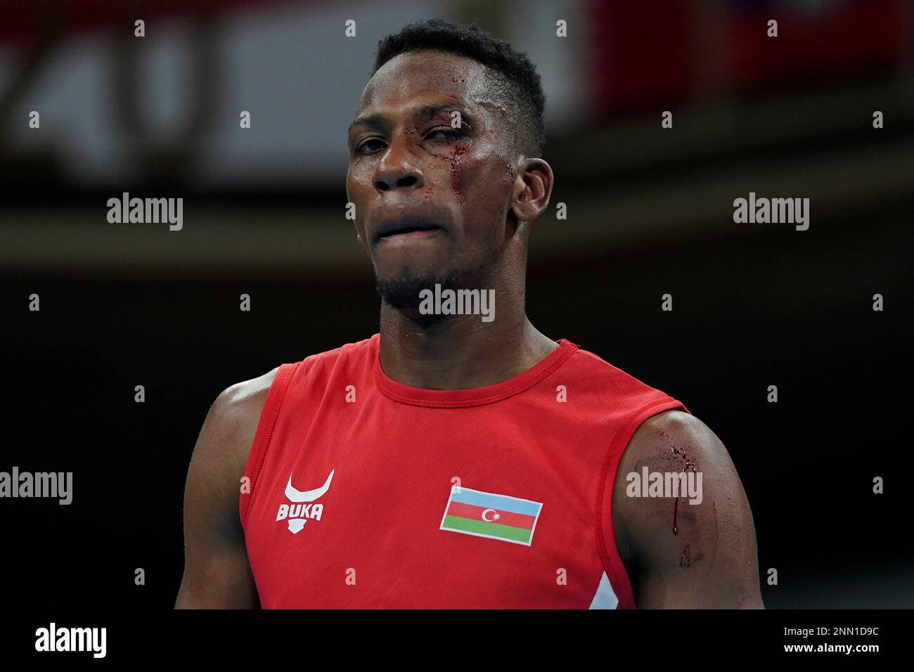 Azerbaijan's Lorenzo Sotomayor Collazo, bleeds from a cut during his ...