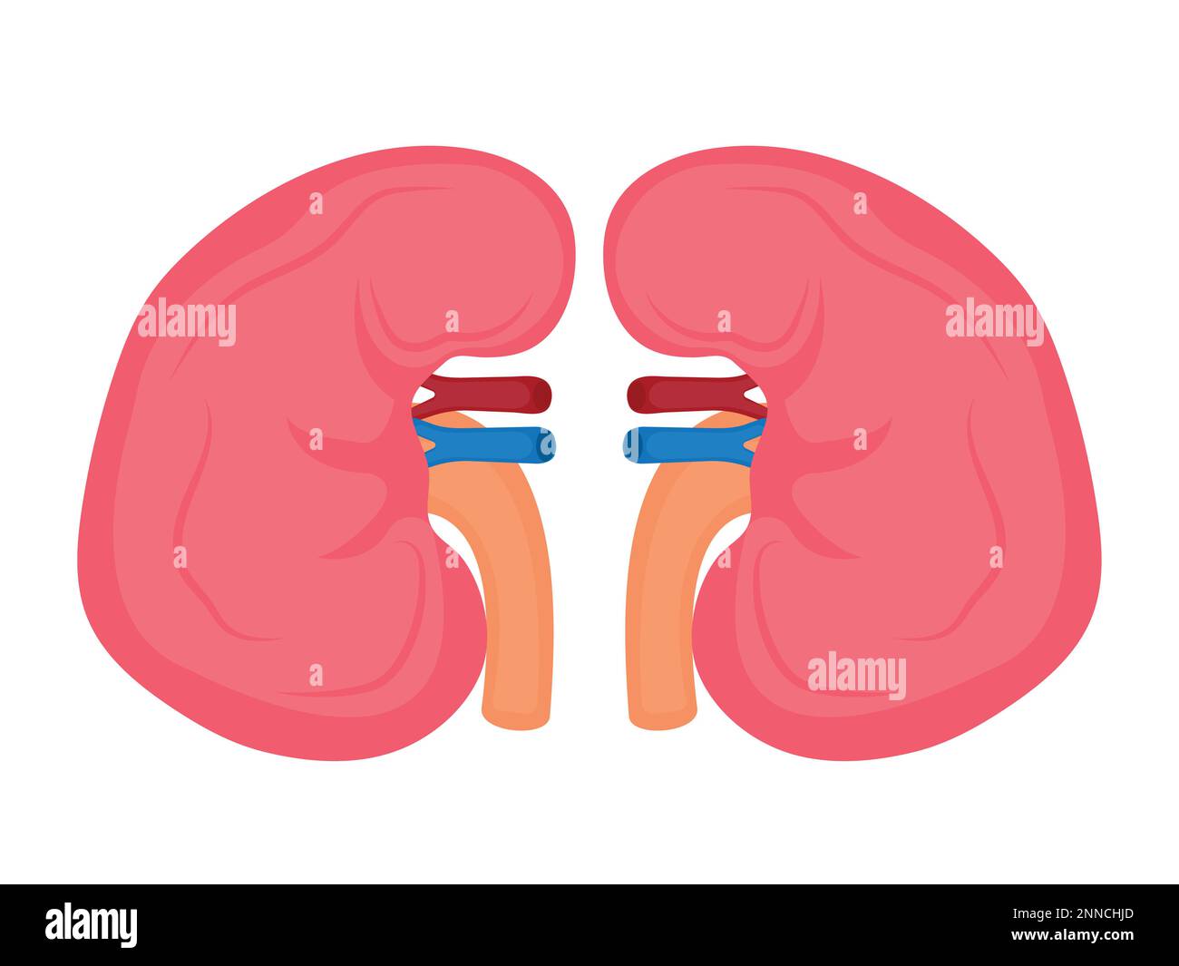 Kidney, glomerulonephritis, pyelonephritis, urolithiasis, polycystic ...