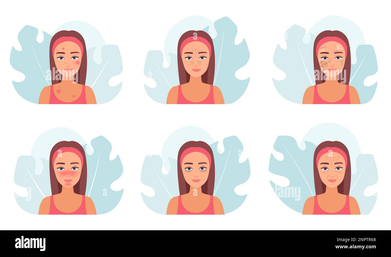 Skin problems set vector illustration. Cartoon infographic medical ...