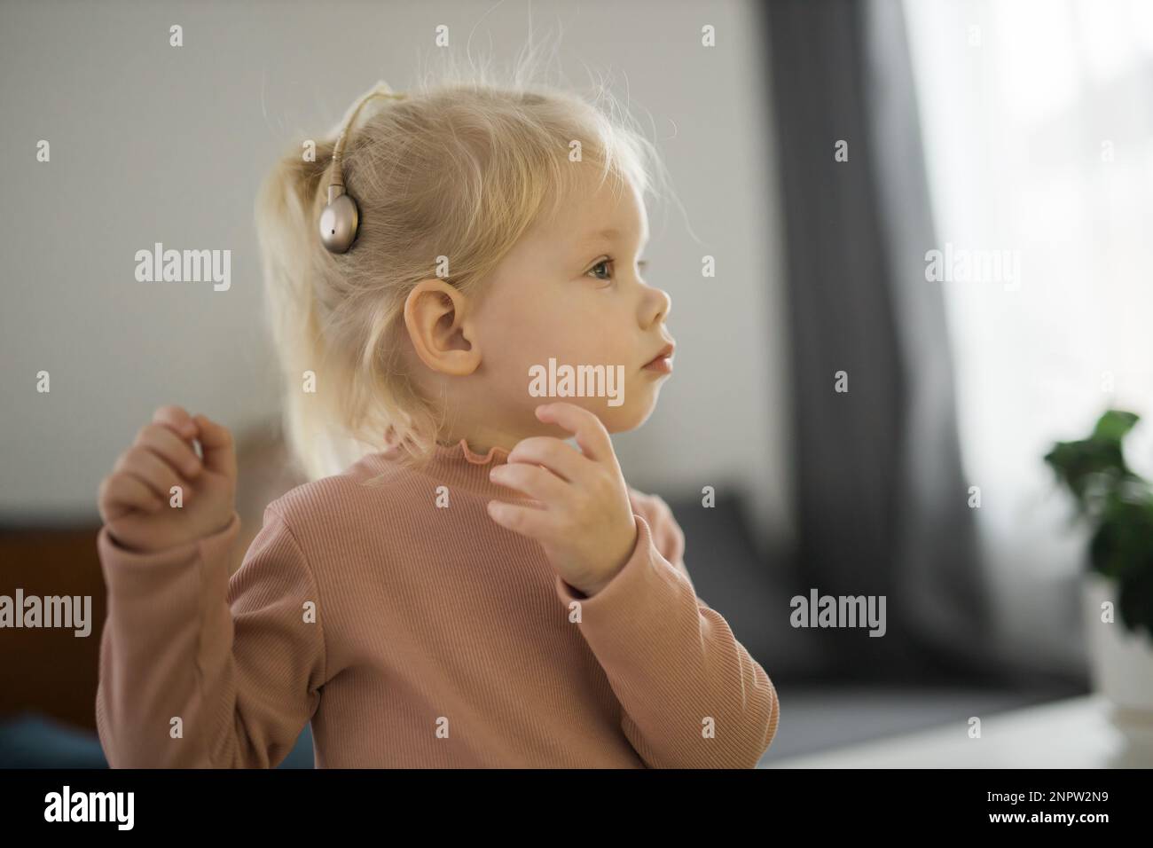 Cochlear implant system. Installation cochlear implant on child girl ...