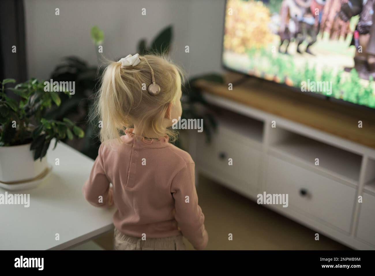 Cochlear implant system. Installation cochlear implant on child girl ...
