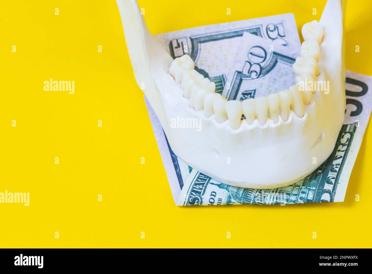 jaw of a human with teeth and banknotes of money, lower jaw,banknote of ...