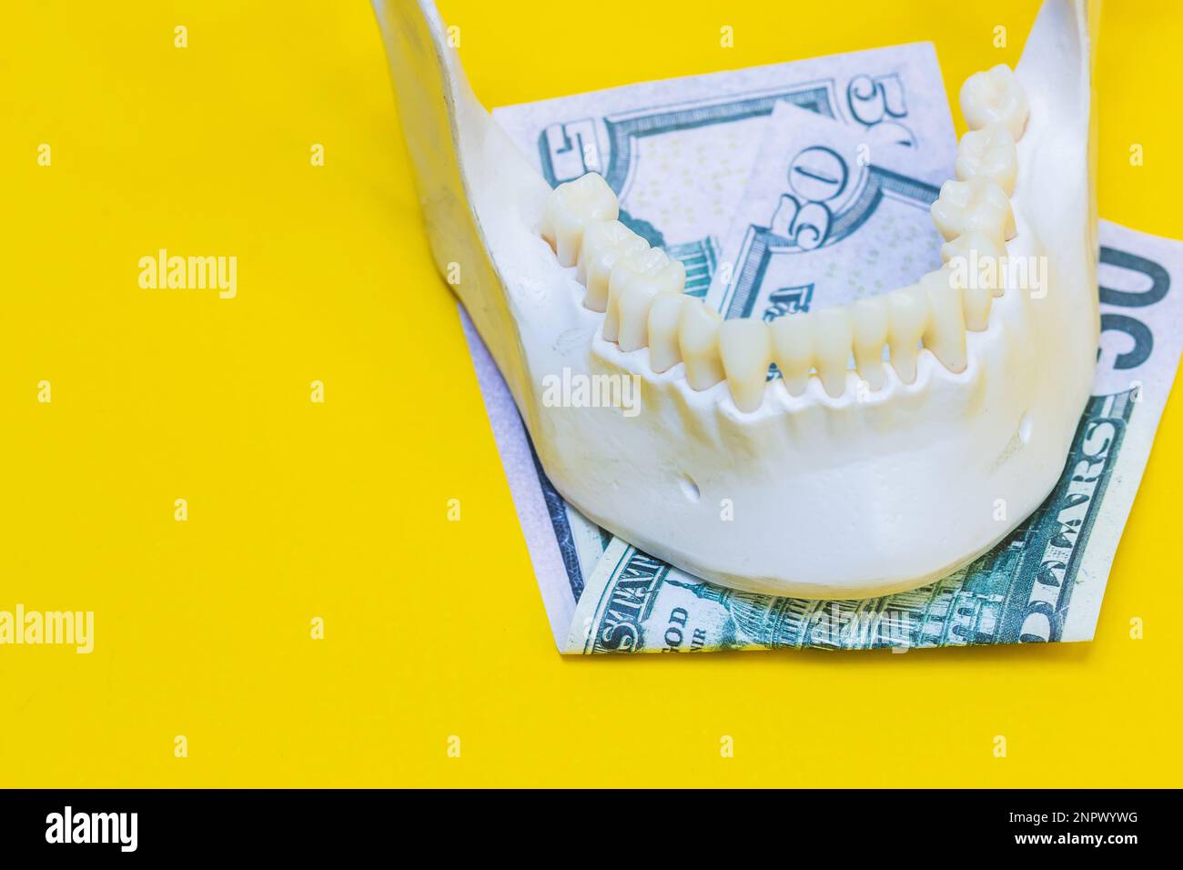jaw of a human with teeth and banknotes of money, lower jaw,banknote of ...