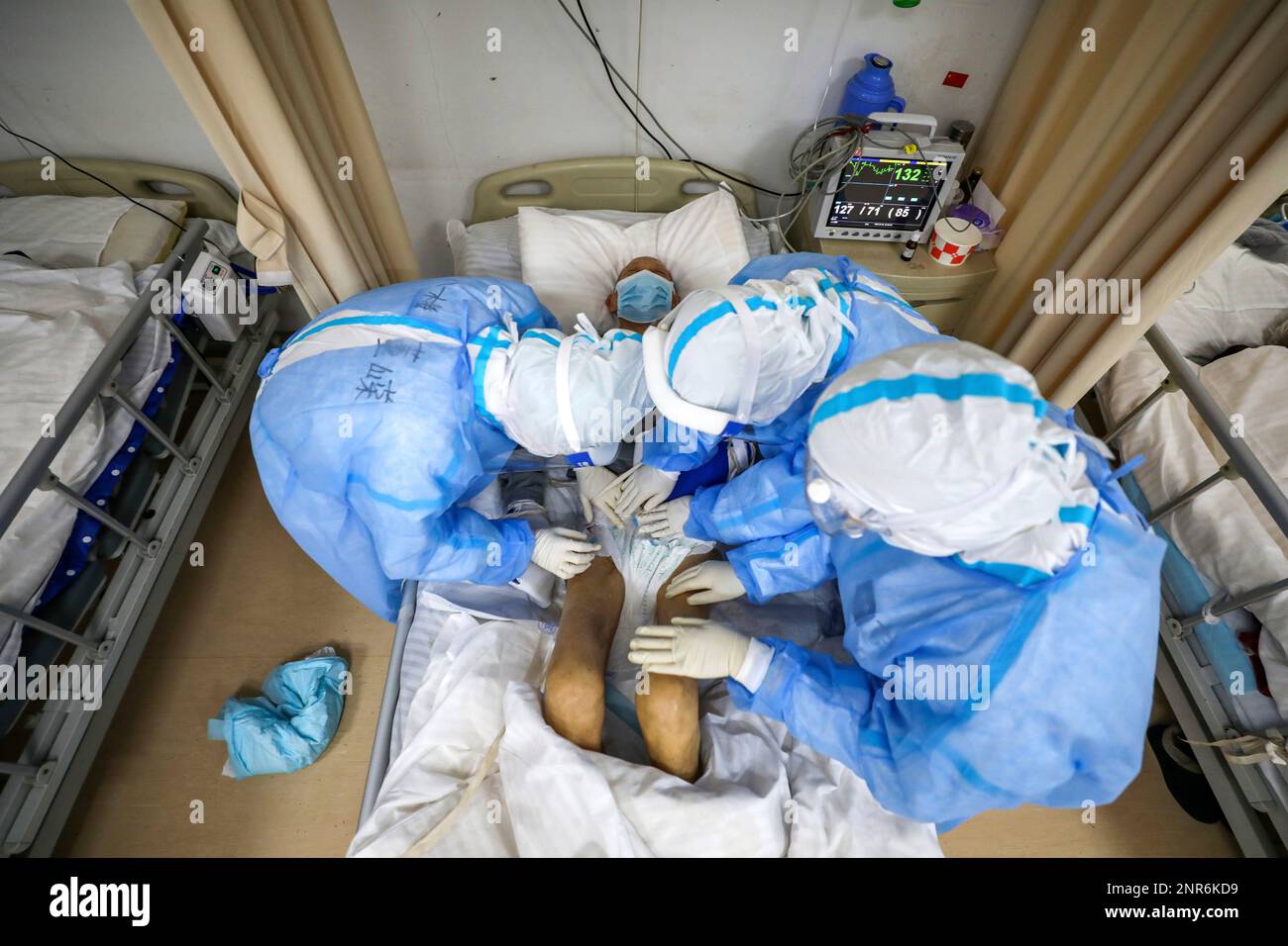 Nurses change diaper for a senile patient in a hospital designated for ...