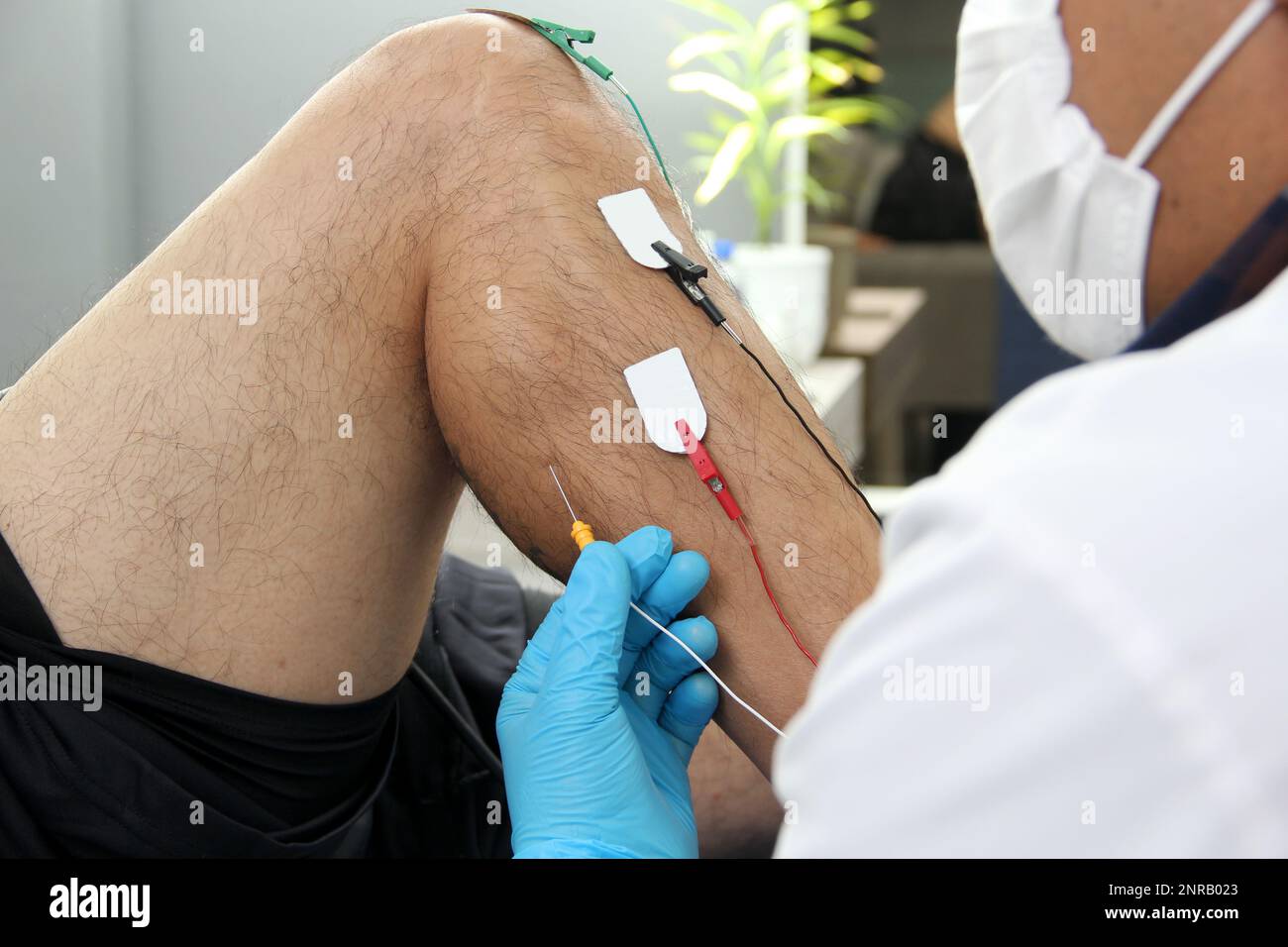 Electromyography EMG and Somatosensory Evoked Potential PEV of lower ...