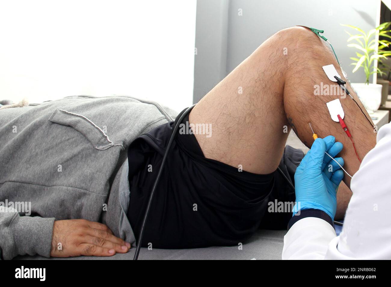 Electromyography EMG and Somatosensory Evoked Potential PEV of lower ...