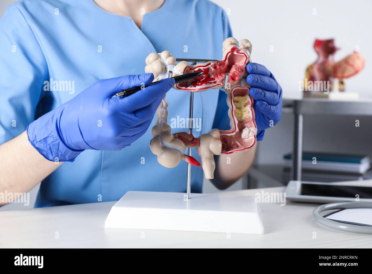 Gastroenterologist showing human colon model at table in clinic ...