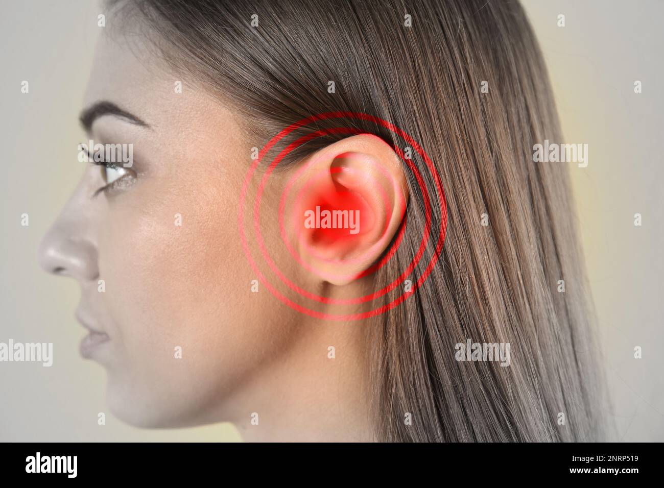 Loss of tone hi-res stock photography and images - Alamy