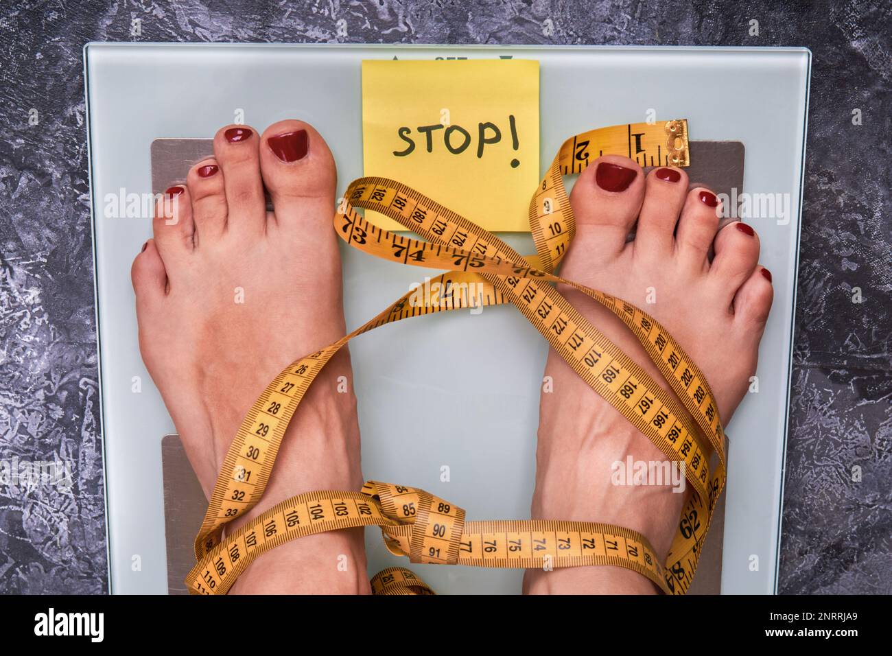 Stop Anorexia nervosa! Society perception, pressure about weight ...