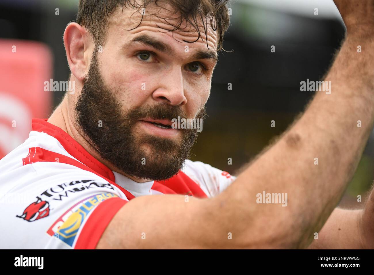 Castleford, England -26th February 2023 - Bloodied Alex Walmsley of St ...