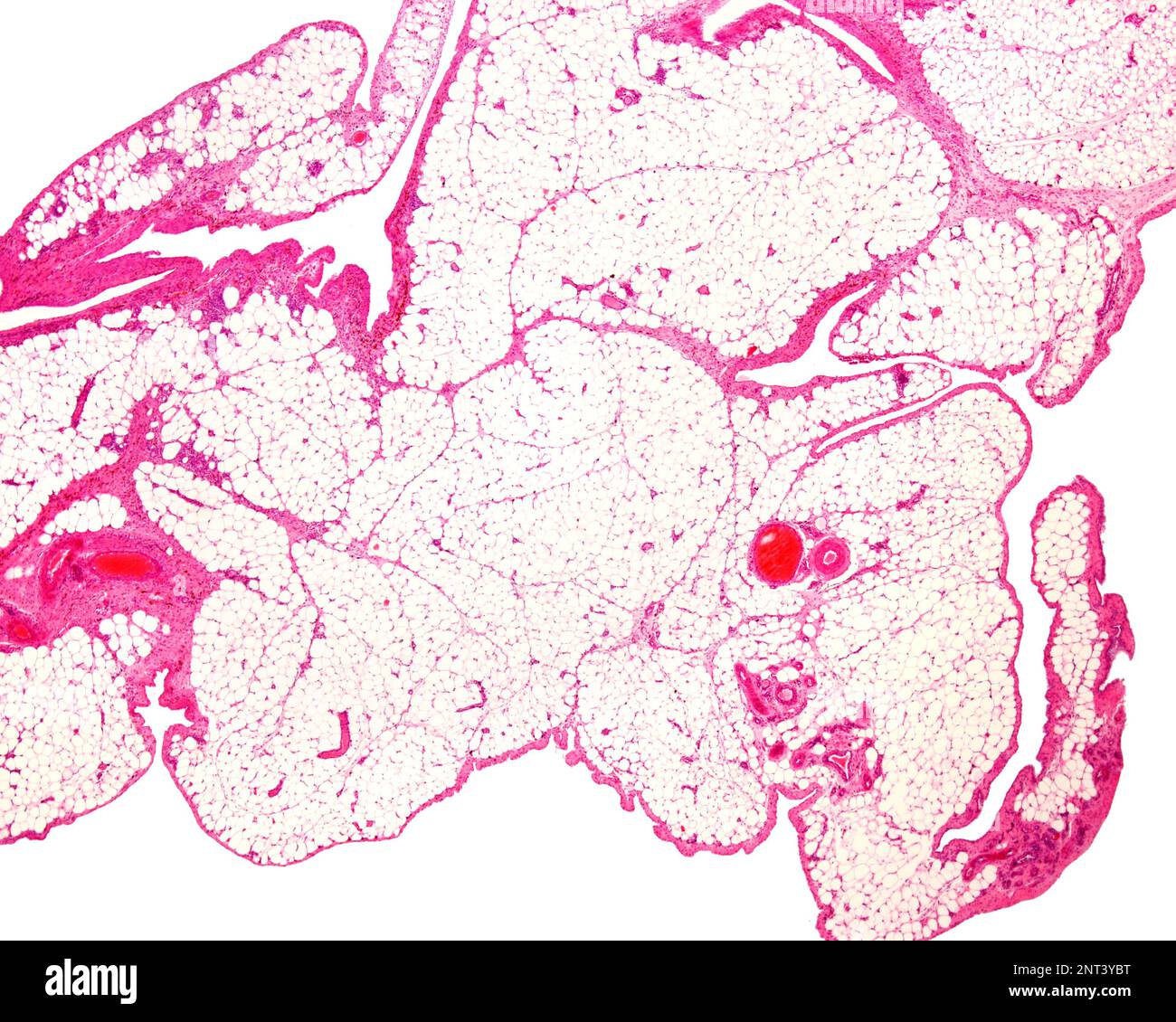 Very Low Magnification Light Microscope Micrograph Of White Adipose Tissue Or Fat Stained With