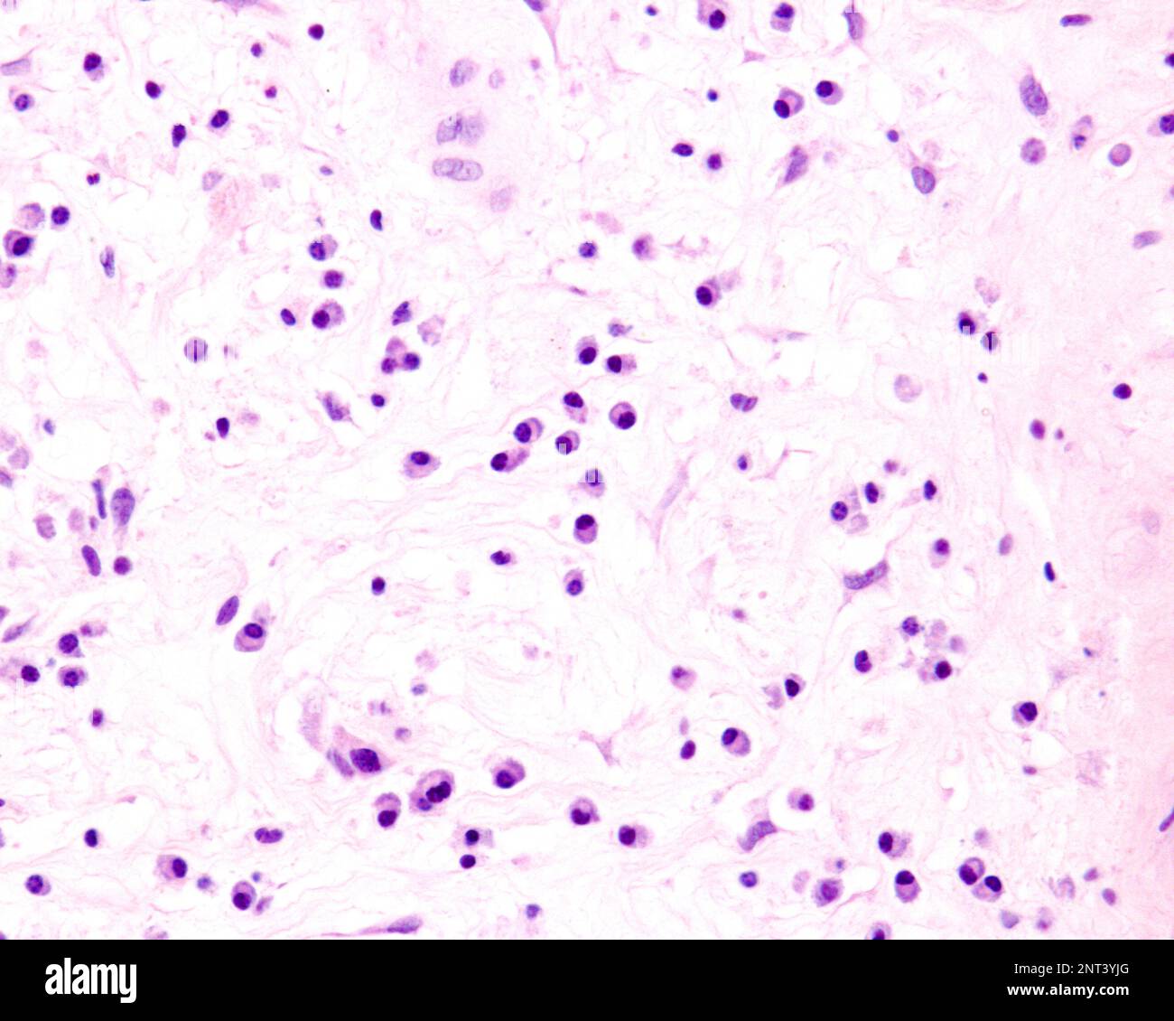 B Lymphocytes Histology
