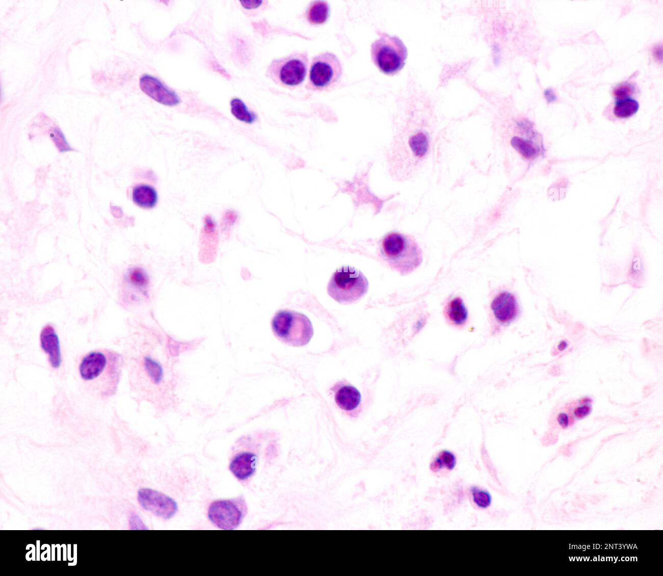 Plasma cells are B lymphocytes activated by the presence of antigens ...