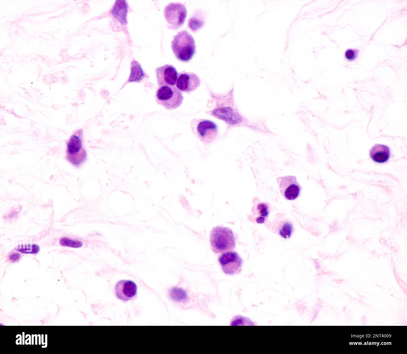 Plasma cells are B lymphocytes activated by the presence of antigens ...