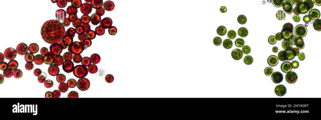 Haematococcus pluvialis green and cyst algae under microscopic view ...