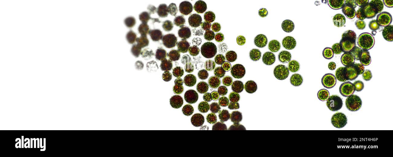 Haematococcus pluvialis green algae under microscopic view, empty space ...