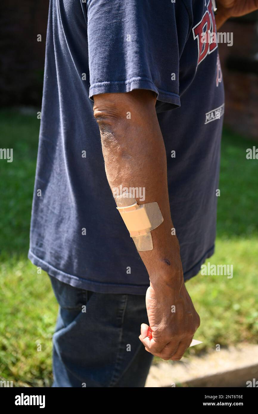 Seen in a July 29, 2019 photo, this man's arm was grazed by a bullet in ...