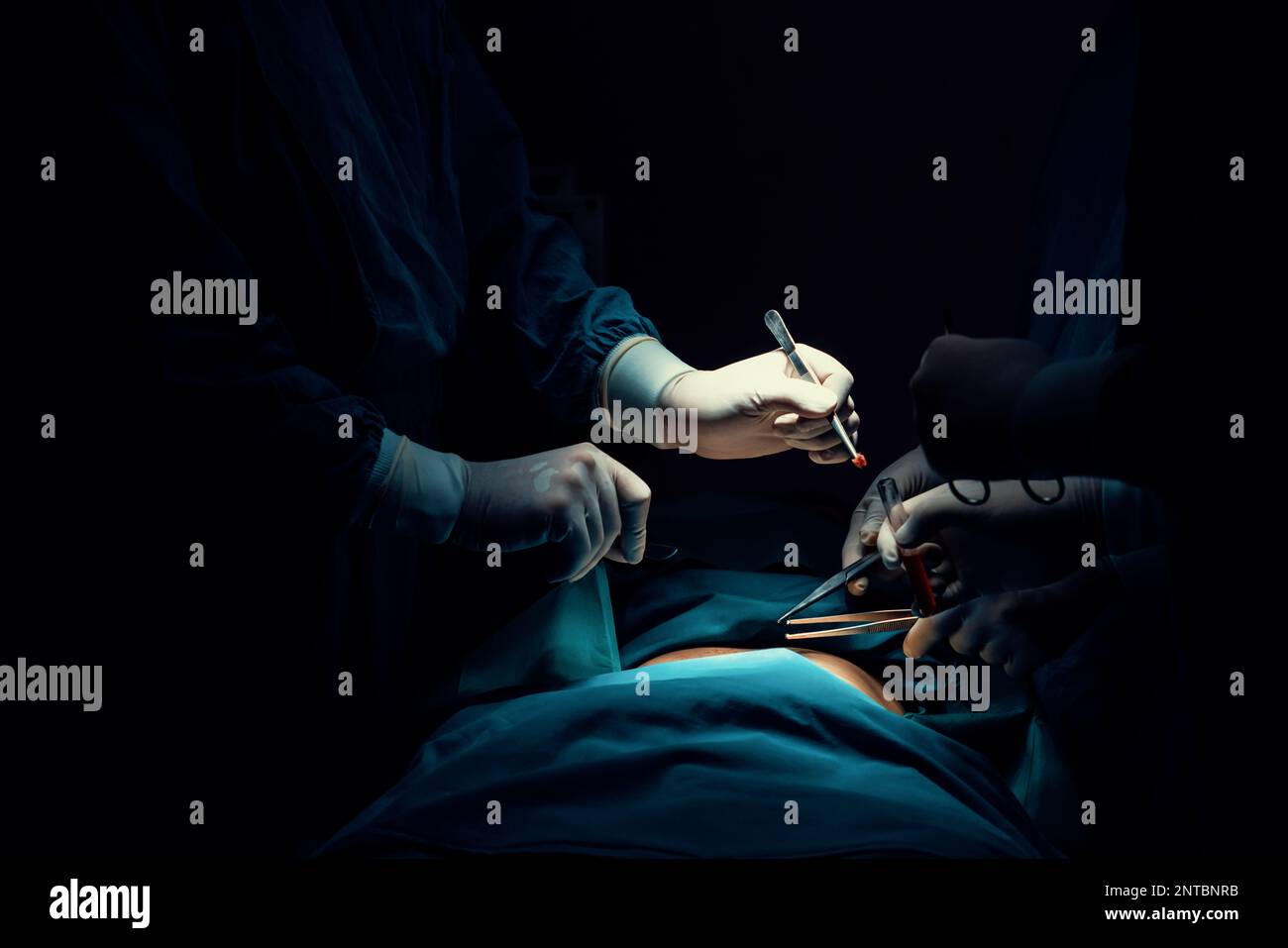 Closeup surgical team performing surgery to patient in sterile ...