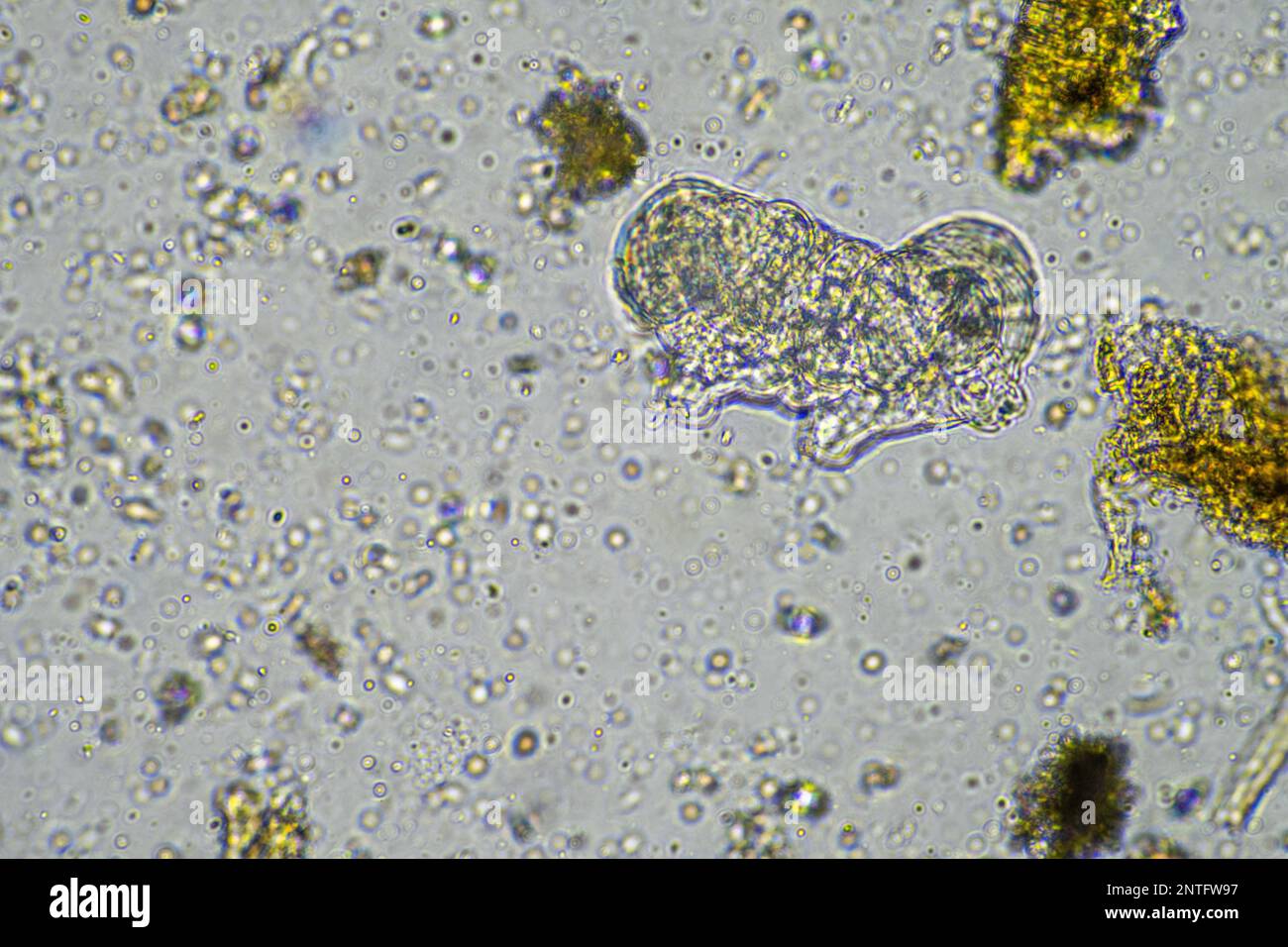 soil microorganisms including nematode, microarthropods, micro ...
