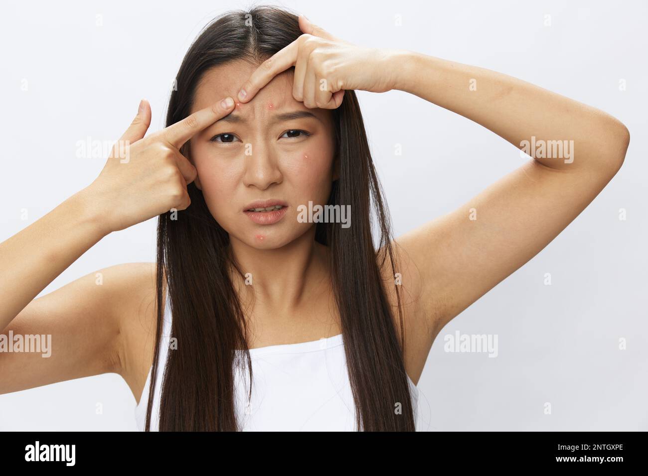 Asian woman facial skin problems, acne and inflammation, red rashes and ...