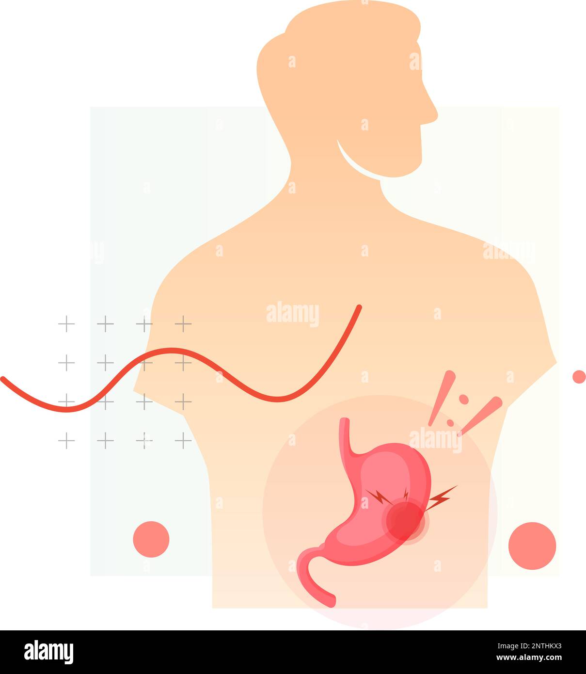 Helicobacter vector vectors hi-res stock photography and images - Alamy