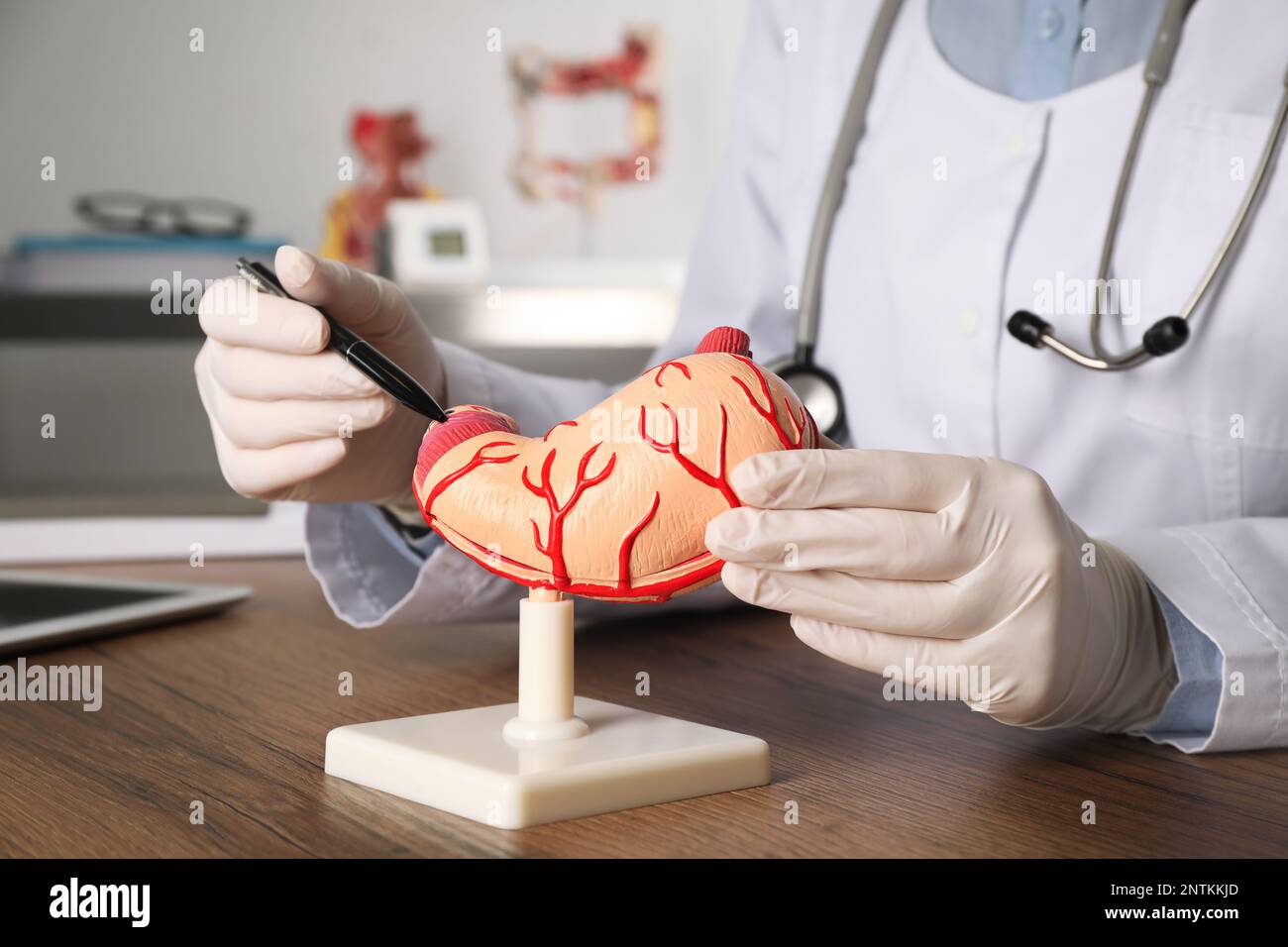 Gastroenterologist showing human stomach model at table in clinic ...