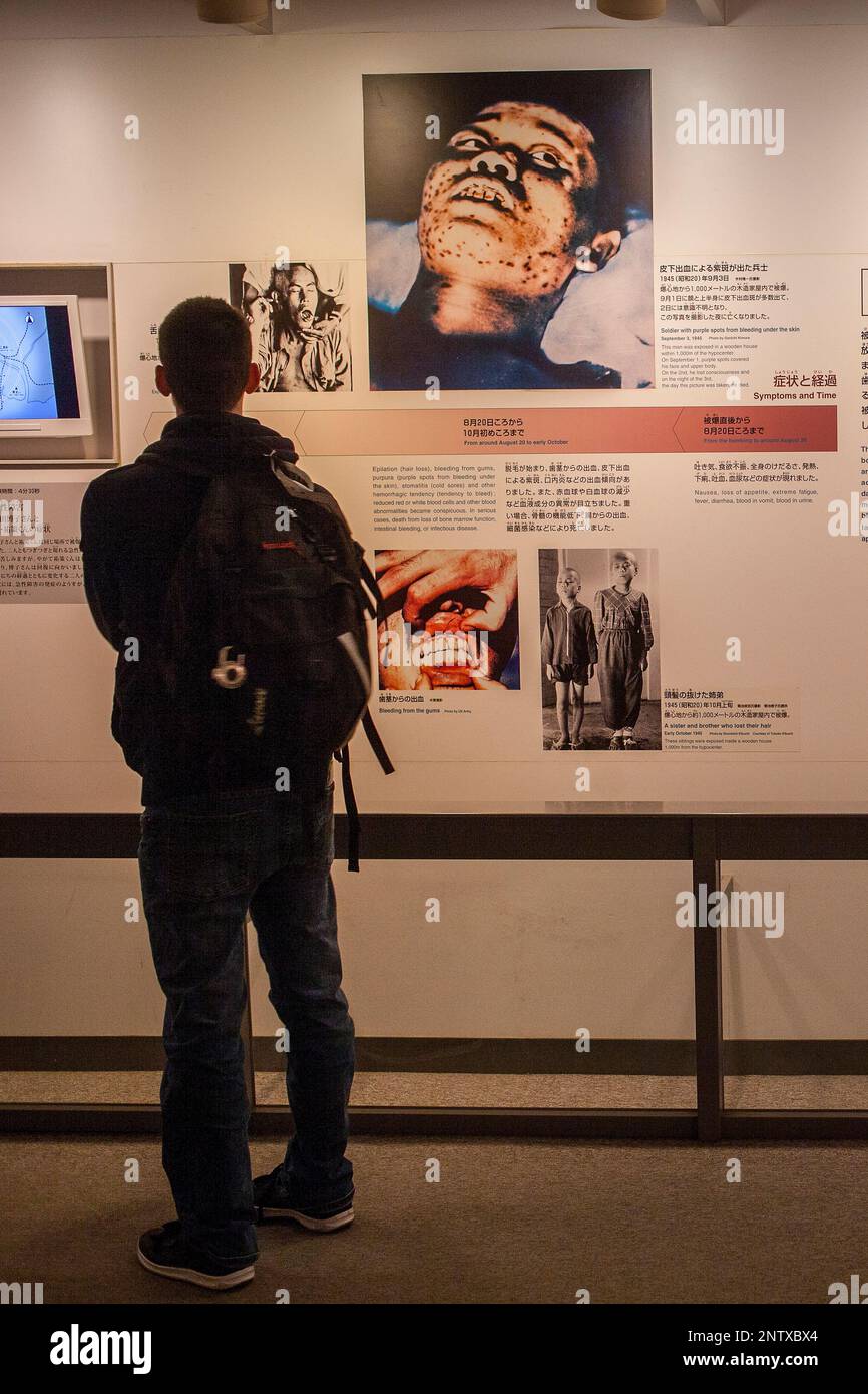 explanation of the effects of the atomic bomb on people after the ...