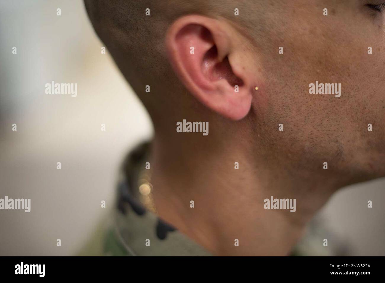 Battlefield acupuncture hi-res stock photography and images - Alamy