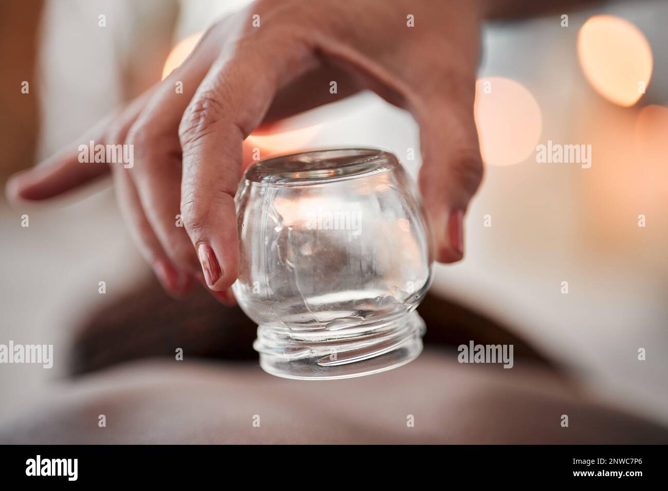 Cupping therapy, glass vacuum cup in hand and woman at spa, therapist ...