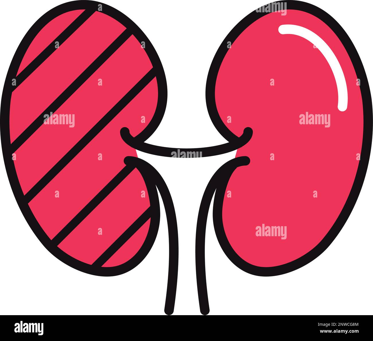 Kidneys diabetes Stock Vector Images - Alamy