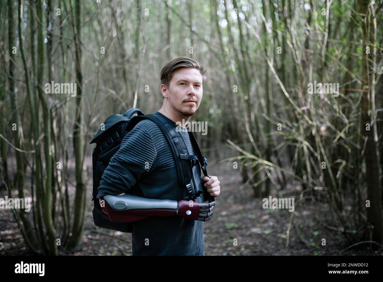 Dan Melville grew up with a prosthetic arm that did not improve his ...