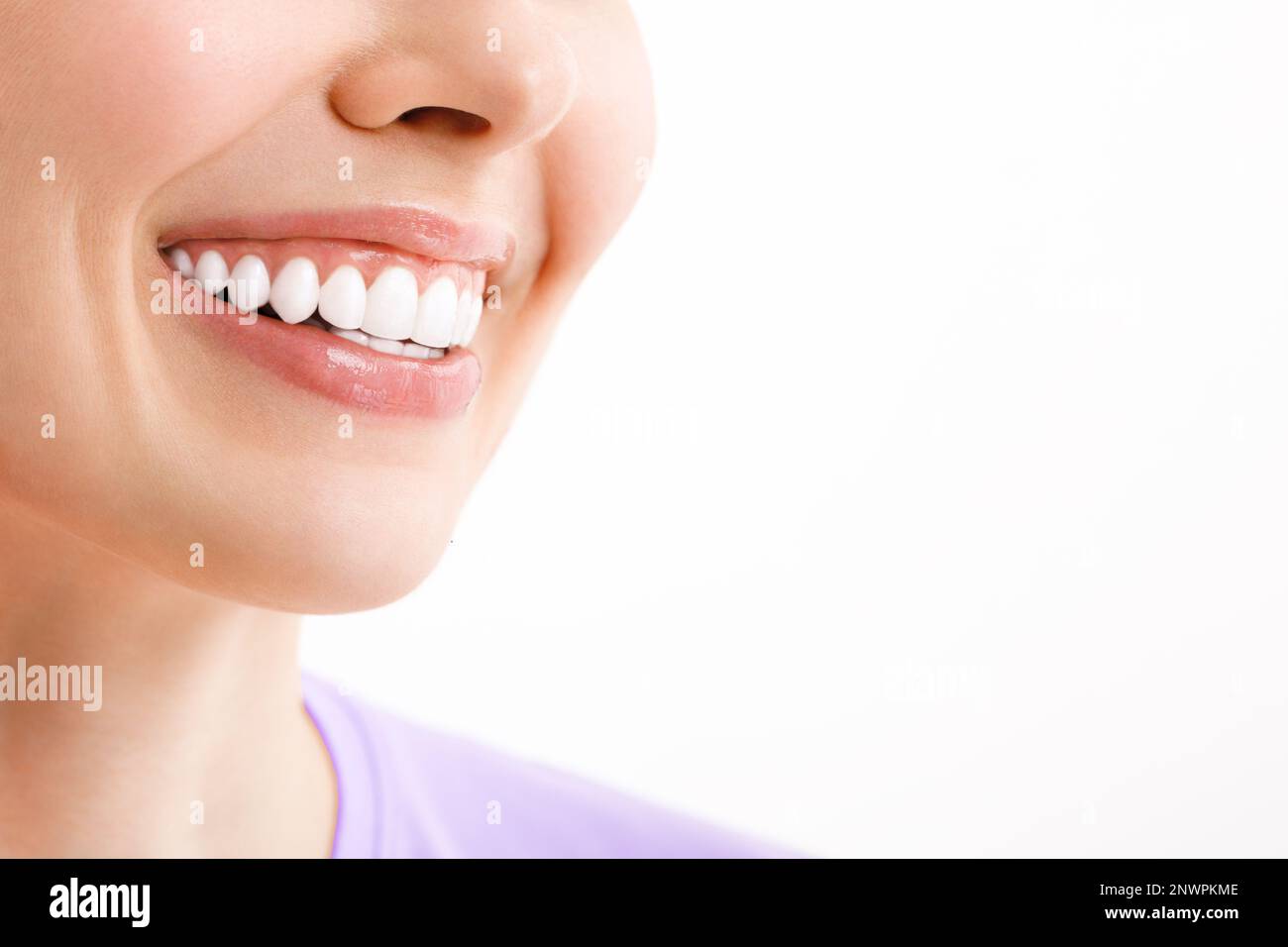 Perfect white teeth smile of a young woman. The result of the teeth ...