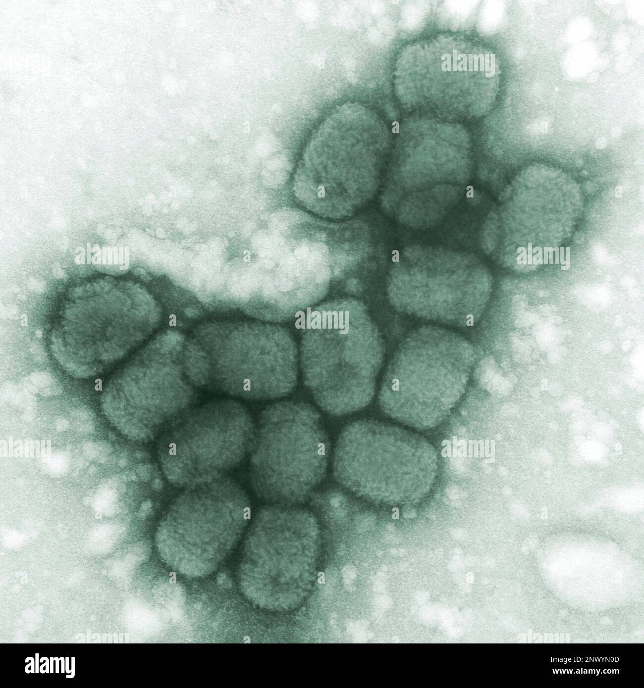 This 1975 microscope image made available by the Centers for Disease ...